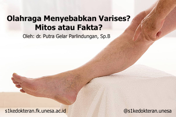 Olahraga Jadi Varises, Mitos atau Fakta?